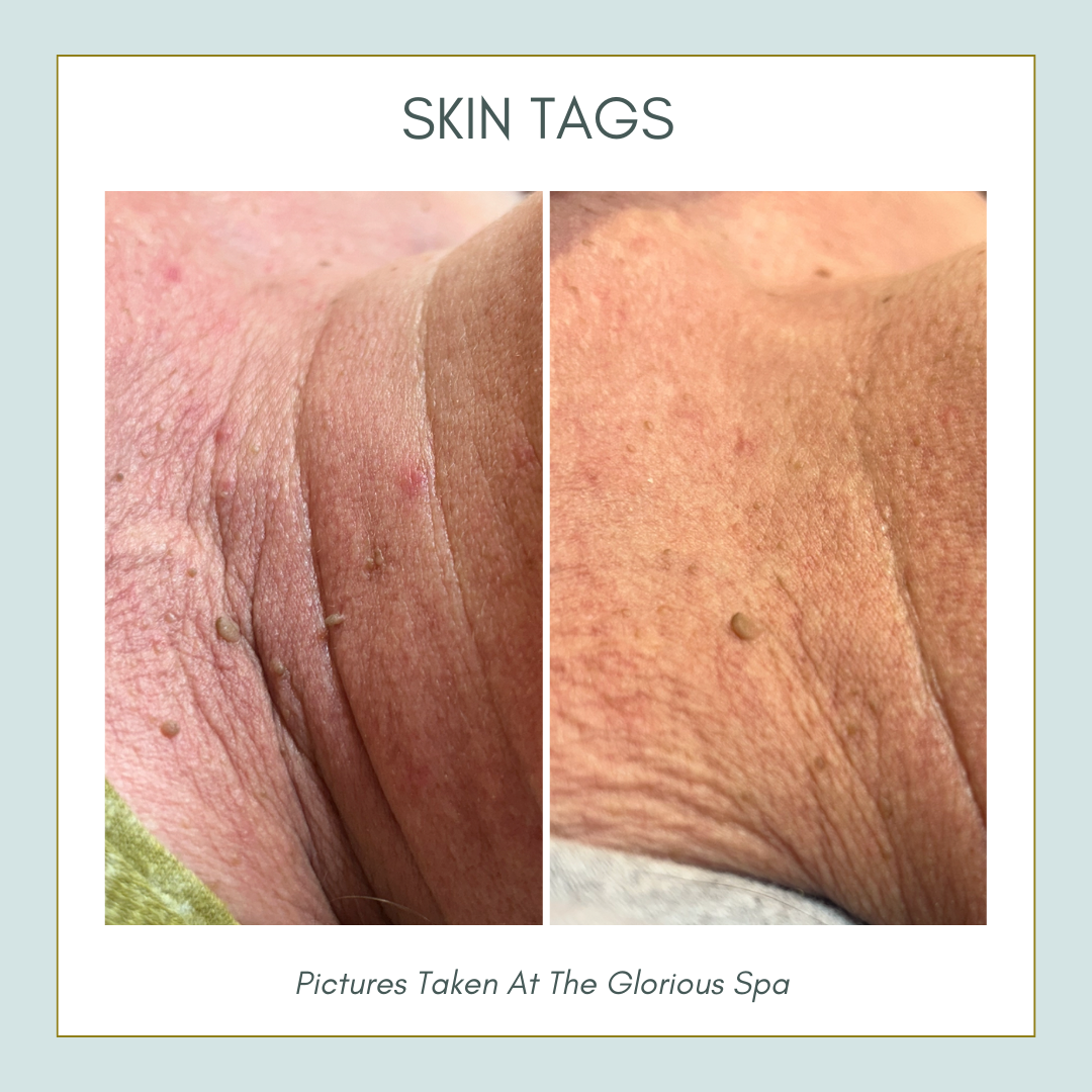 The Glorious Spa Company